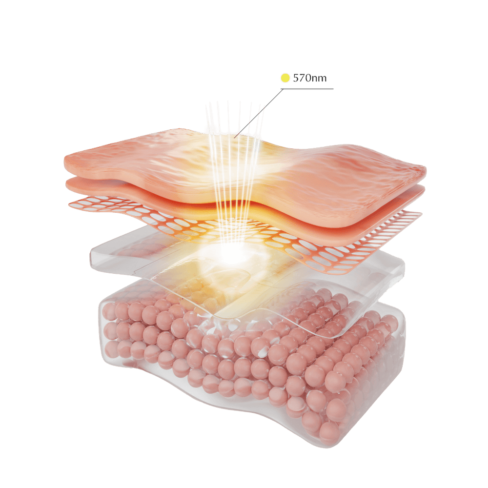 The brightening impact: yellow light therapy in skincare